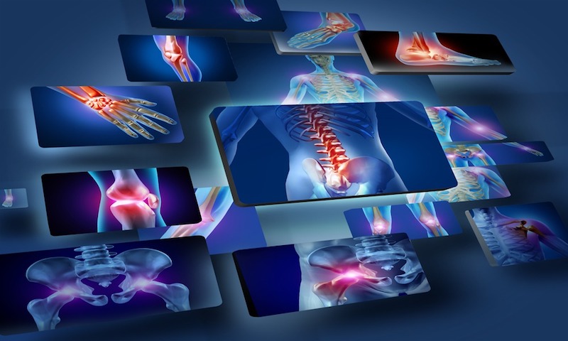 ST3 Orthopaedic Interview - Getting Into Orthopaedic Specialty Training